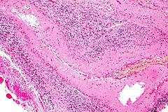 Neuropathology - Libre Pathology