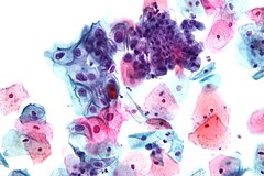 Gynecologic cytopathology - Libre Pathology